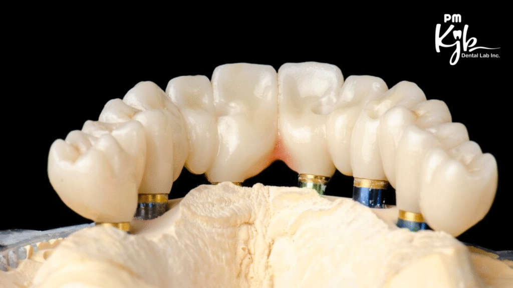 Comprehensive Guide to Dental Crowns and Bridges for Dentists