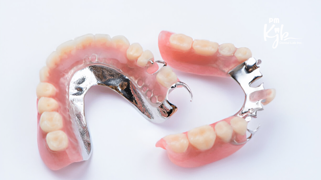 Enhancing Metal Partial Dentures with Precision Casting Technology